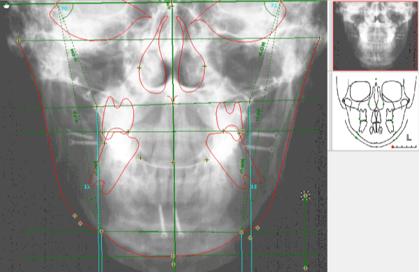 Software Cefalométrico