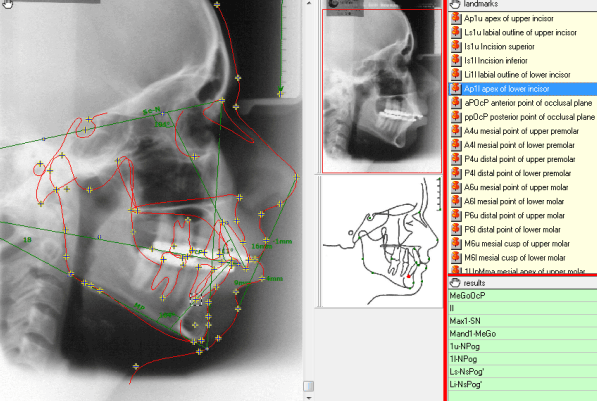 Software Cefalométrico